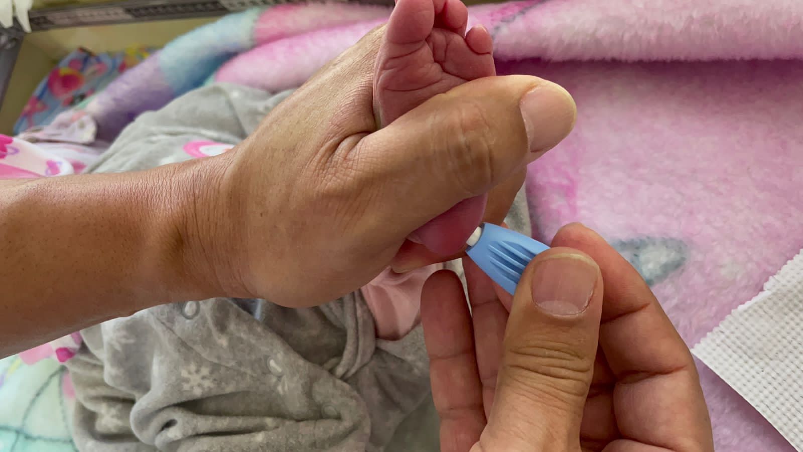 Tamiz metabólico neonatal, estudio que debe practicarse a todo recién ...